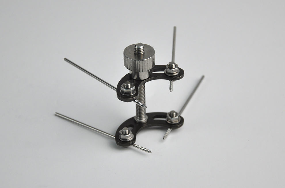 What Are The Three Types Of External Fixators? | Aysam