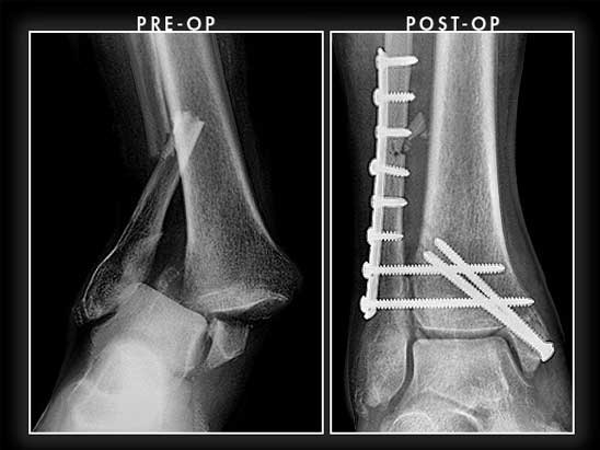 Platin Nedir? Platin Ne İşe Yarar? | Aysam